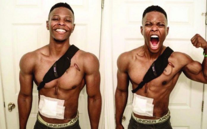 Meet The Fitness Model Who Lives Without A Pulse – Fitness Volt