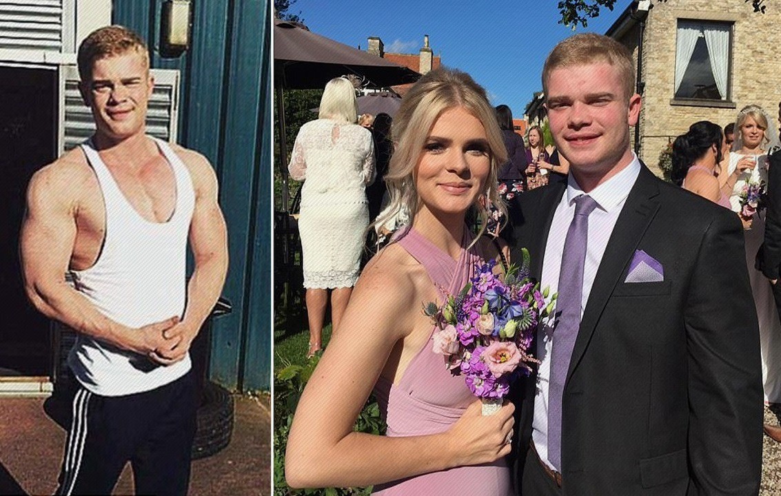 20 Years Old Bodybuilder, Died After Taking Steroids That He Bought on ...