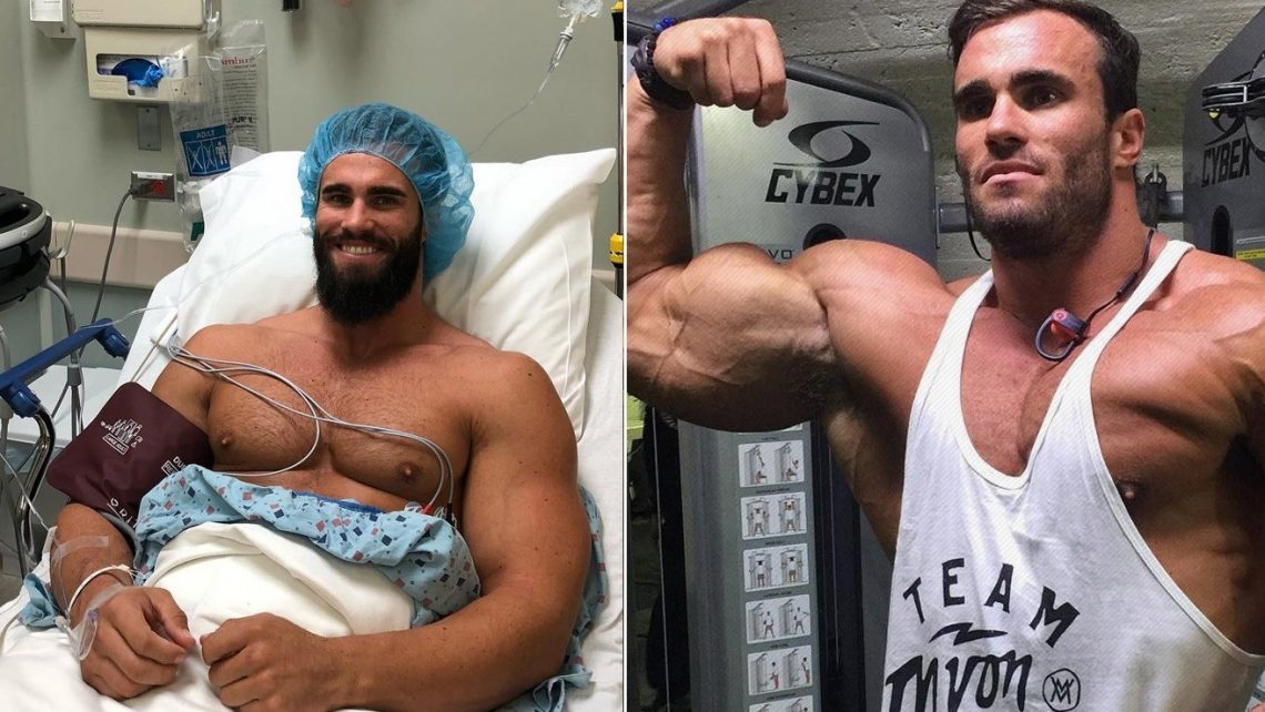 Calum Von Moger Once Again Undergoing Bicep Surgery – Fitness Volt