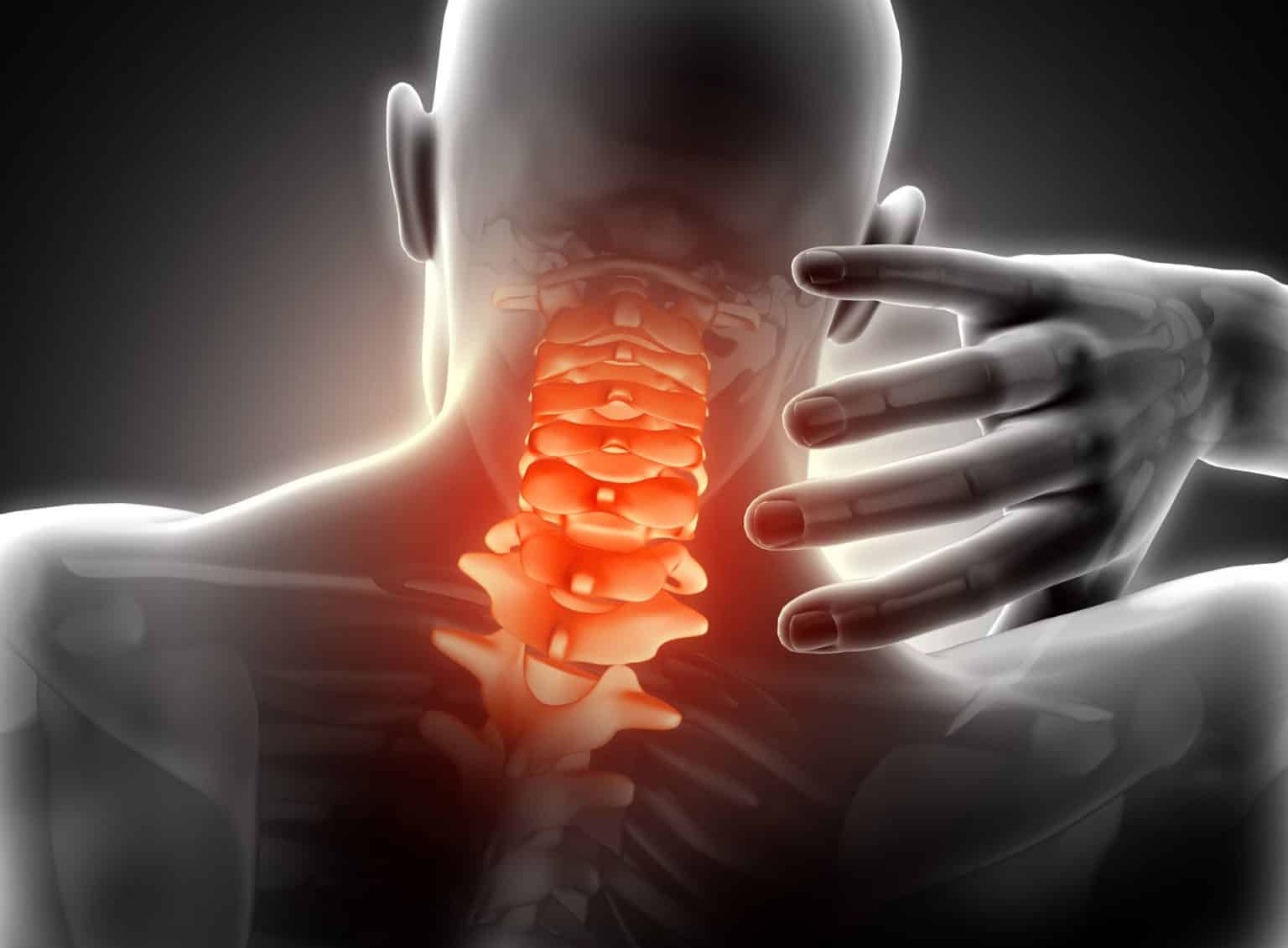 Exercises to Fix Your Nerd Neck and Desk Slouch – Fitness Volt