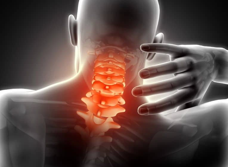 Exercises to Fix Your Nerd Neck and Desk Slouch – Fitness Volt