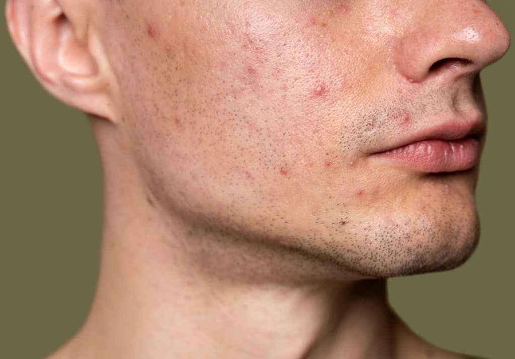 Creatine Side Effects — Unveiling the Truth To Safely Boost Your Gains