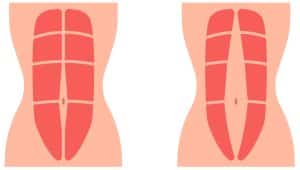 15 Best Diastasis Recti Exercises for Moms to Get Their Body Back