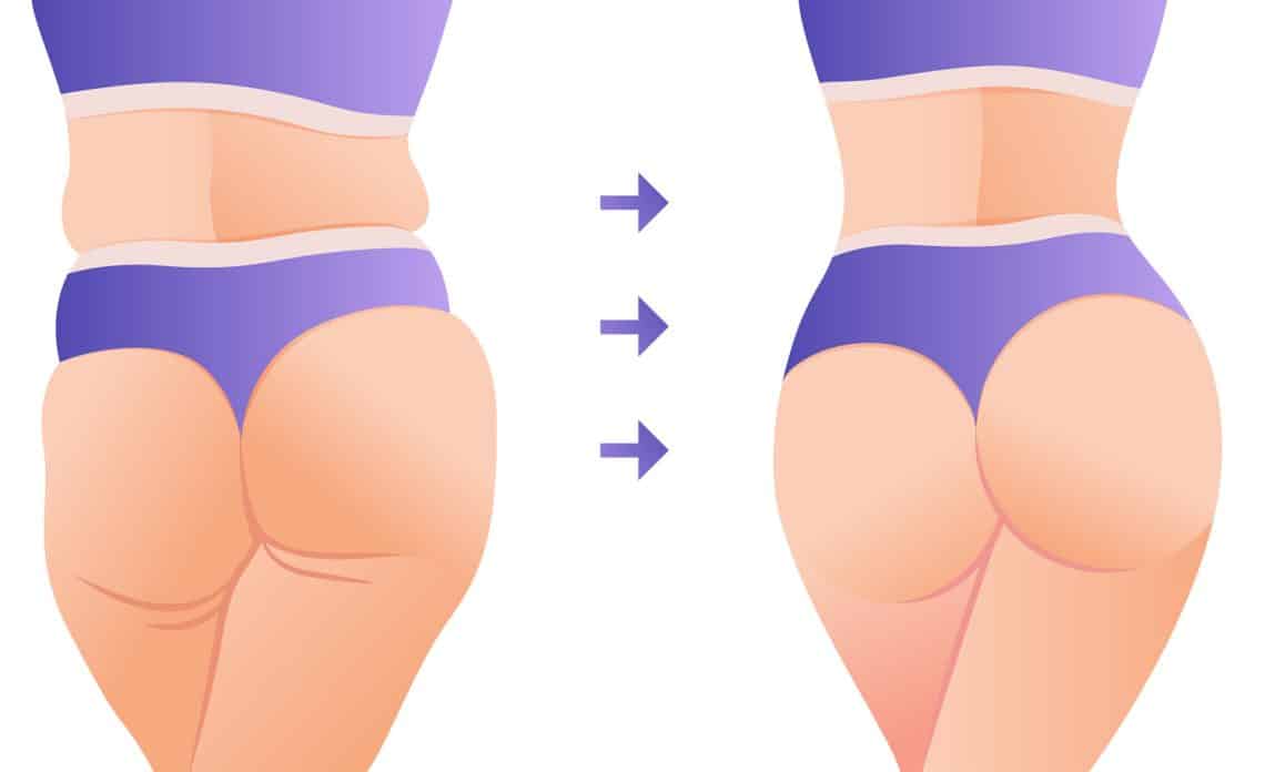 How To Turn Your Square Butt Into a Bubble Bum [12 Best Exercises Inside]