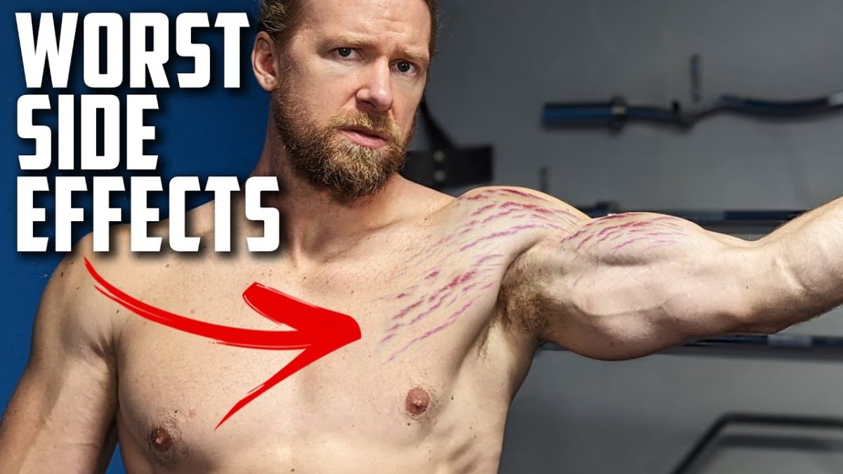 Buff Dudes Share The Worst Side Effects Of Bodybuilding No One Wants To Buff Dudes Share The Worst Side Effects Of Bodybuilding No One Wants To