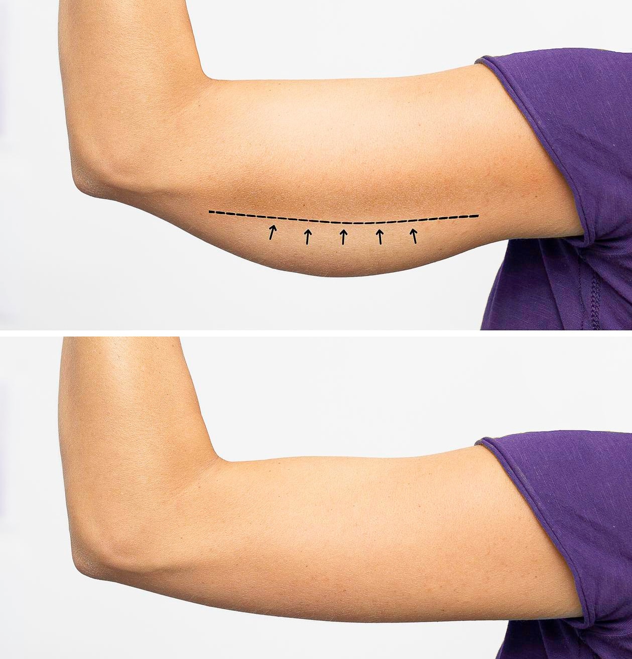 26 Exercises For Flabby Arms and Bat Wings — FitnessVolt.Com