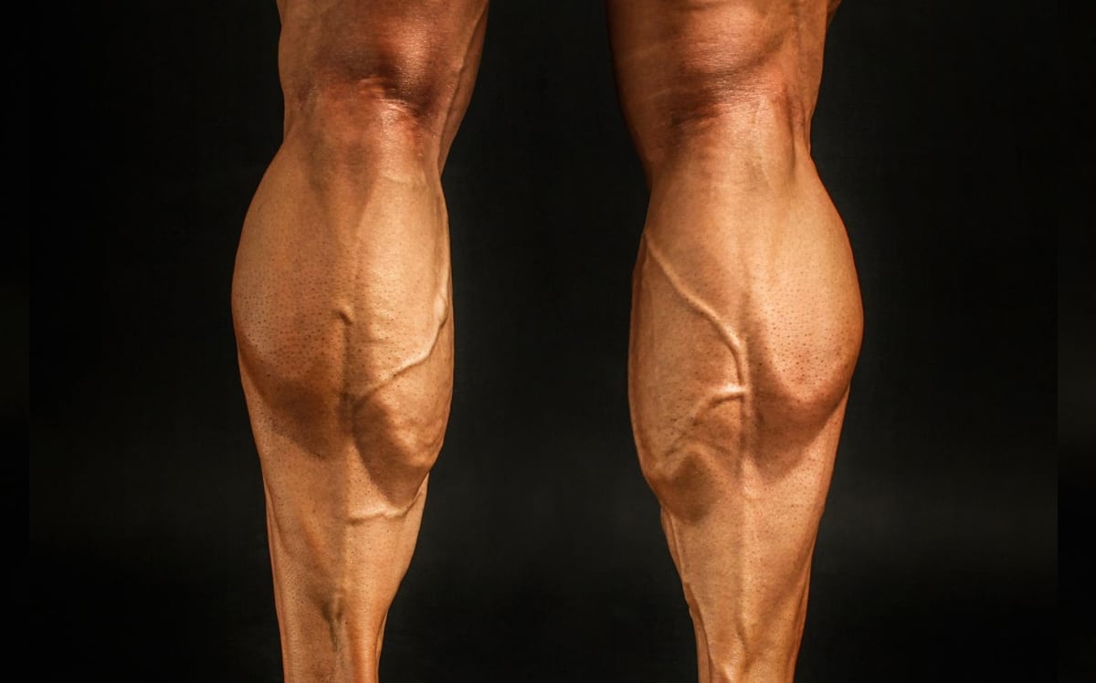 Are Calves Genetic Unlocking The Mystery Of Lower Leg Growth Are Calves Genetic Unlocking The Mystery Of Lower Leg Growth