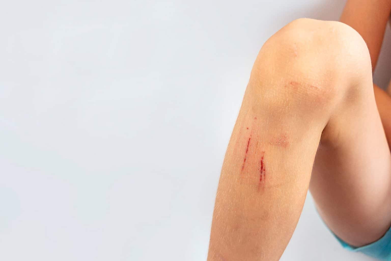 The Best Exercises and Stretches for Leg Pain – Fitness Volt