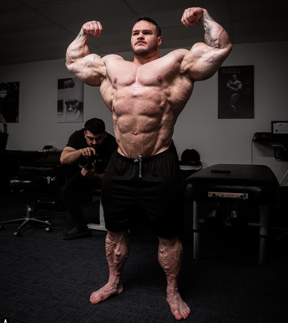 Nick Walker Talks Hamstring Training Since Injury, Says Deadlifting ...