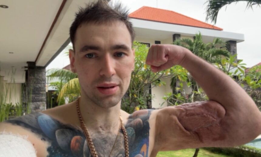 Synthol Kid Kirill Tereshin Shows Off Drained Bicep, Opens Up About ...